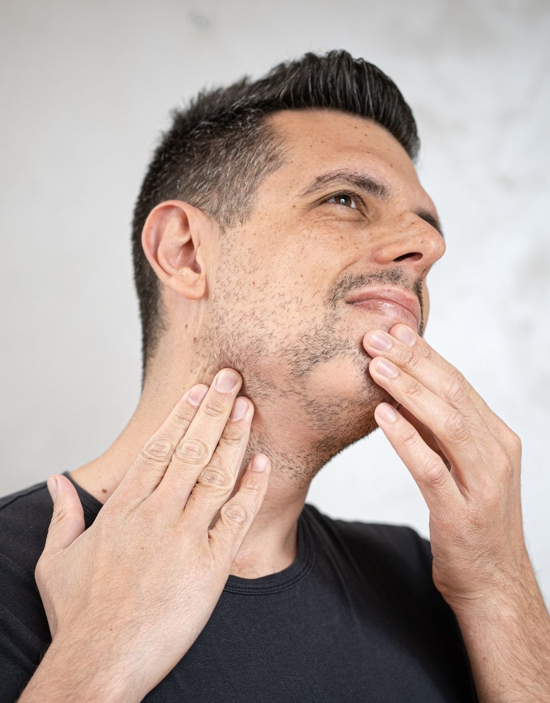 Alopecia Barbae Treatments Causes Symptoms The More Clinics