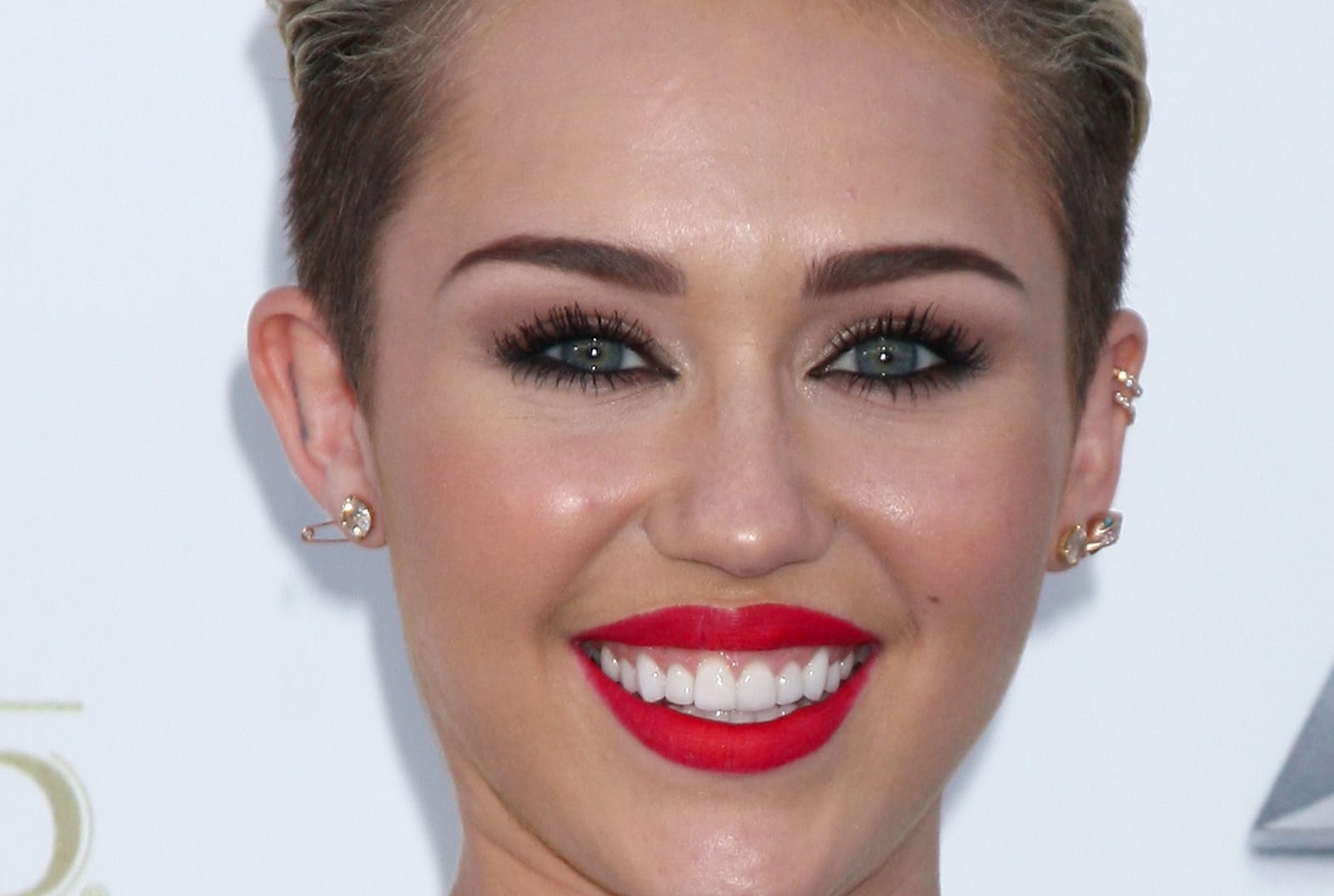 Celebrities with Veneers Before and After - The More Clinics