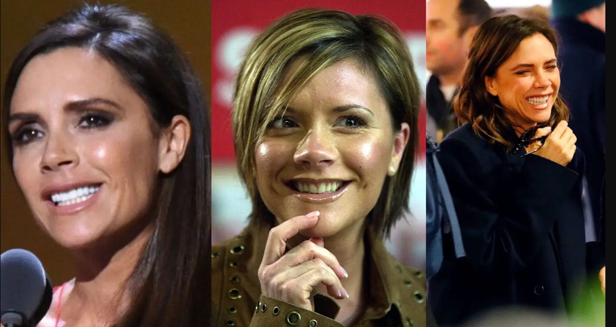 Celebrities with Veneers Before and After - The More Clinics