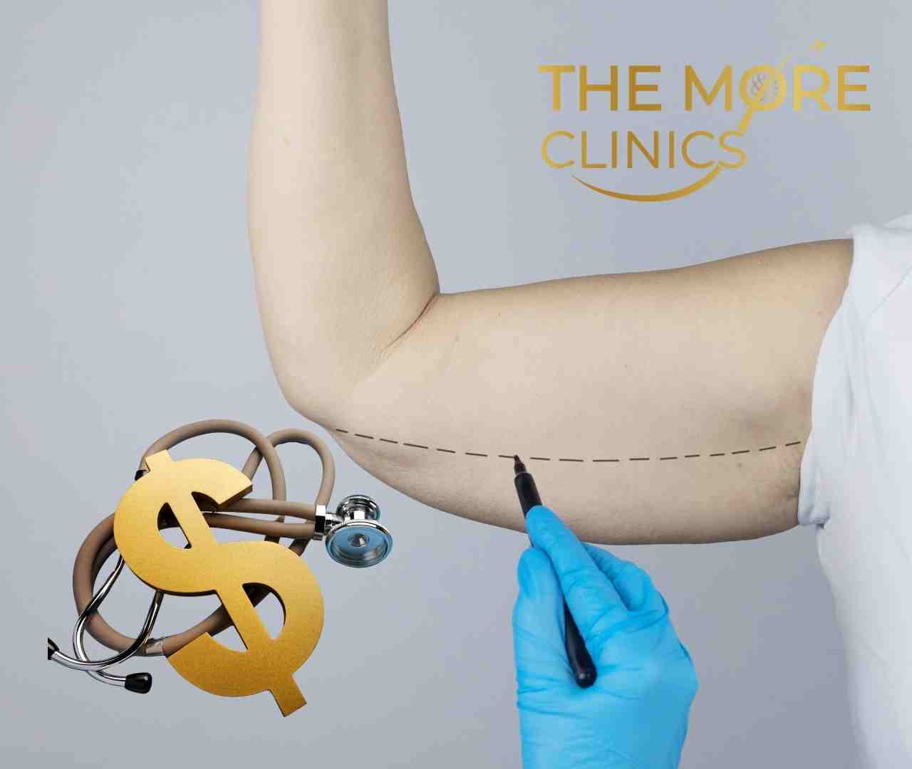Brachioplasty Cost Guide: How Much Does an Arm Lift Cost? - The More ...