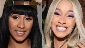 Celebrities with Veneers Before and After - The More Clinics