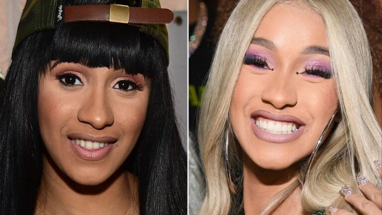 Celebrities with Veneers Before and After - The More Clinics
