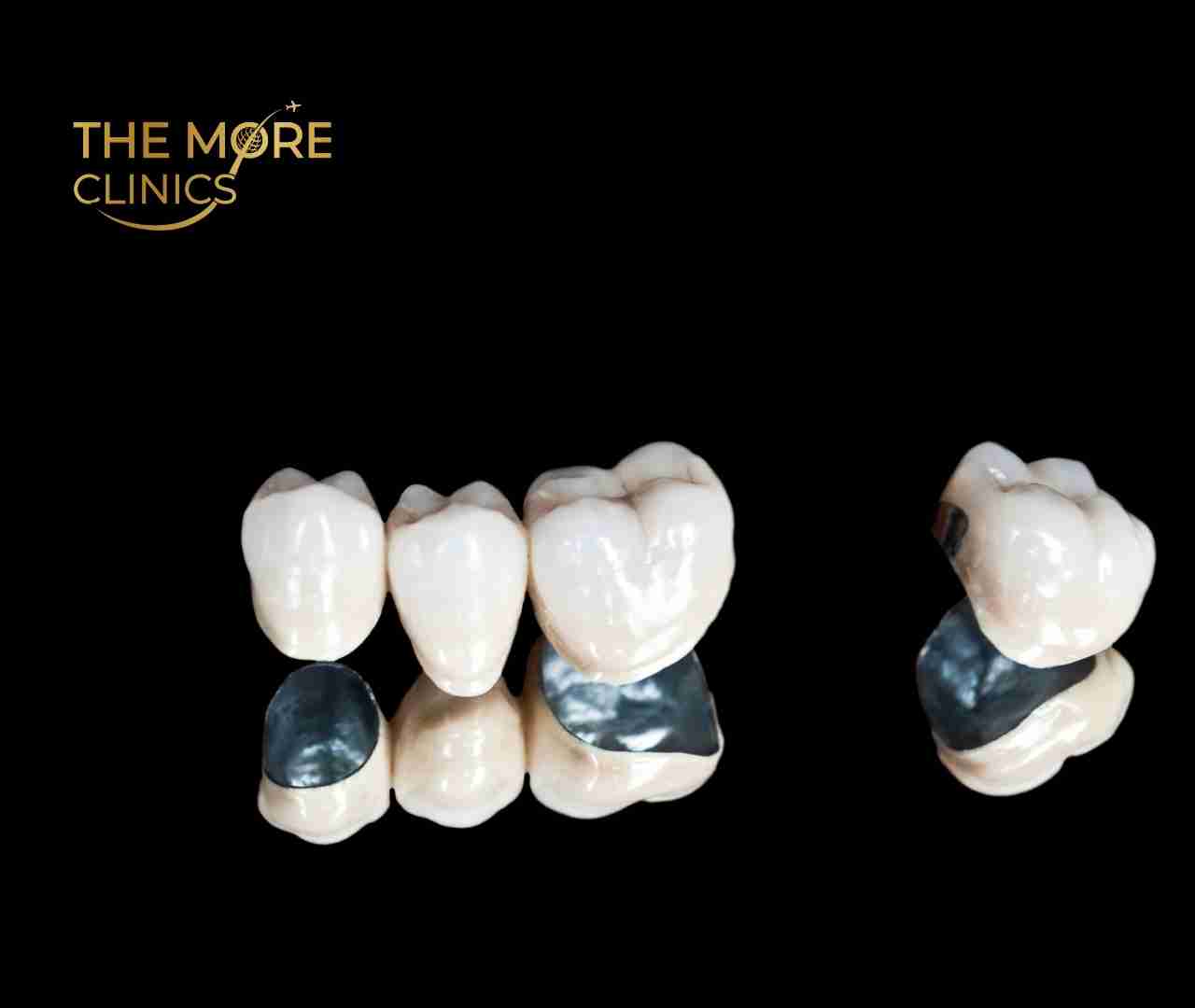 Types of Dental Crowns and Cost - All about Tooth Crown