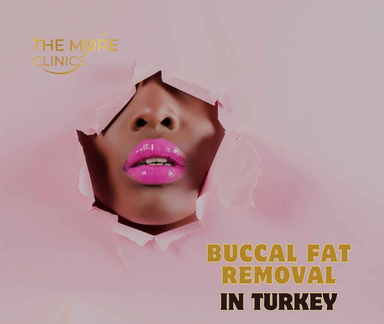 Buccal Fat Removal Cost, Before and After Results, Turkey Option